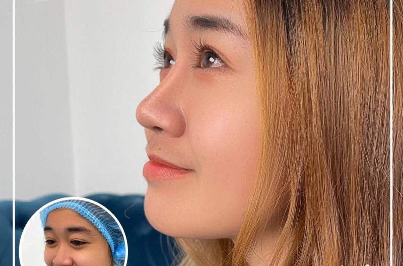 ค้นหา - ออนฟอน | Onfond