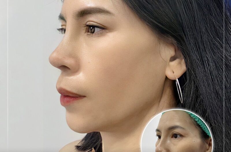 ค้นหา - ออนฟอน | Onfond