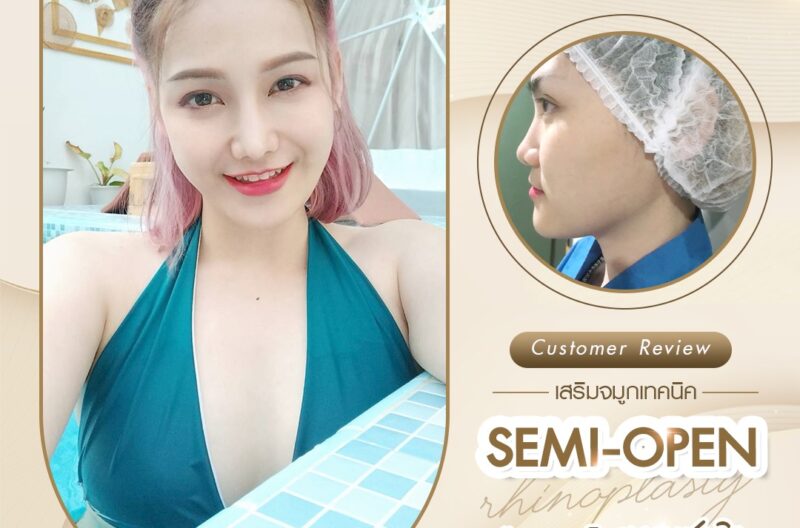 ค้นหา - ออนฟอน | Onfond