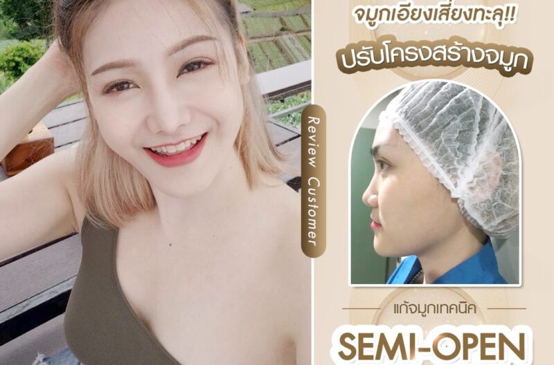 ค้นหา - ออนฟอน | Onfond