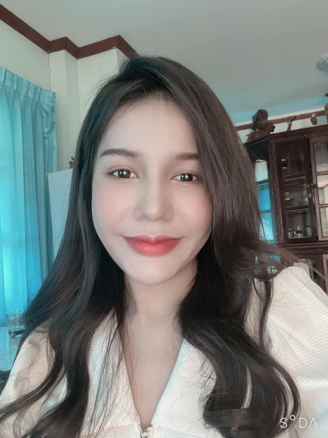 รวมเคสรีวิว ทำปากกระจับสวยเป็นธรรมชาติ จากคลินิกดัง Sowon Clinic - ออนฟอน | Onfond